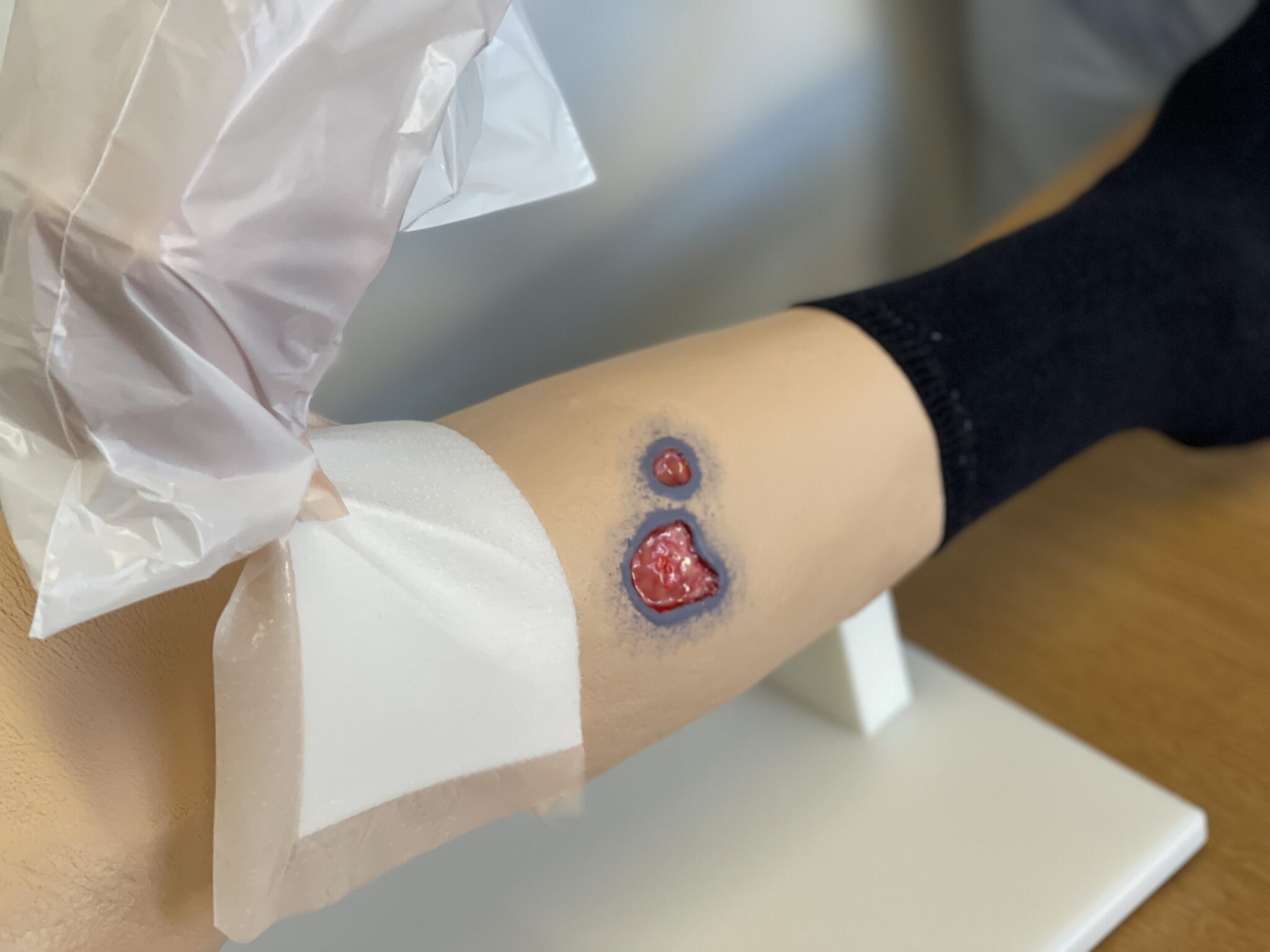 How to change a simple wound dressing - Wirral Community Health and ...