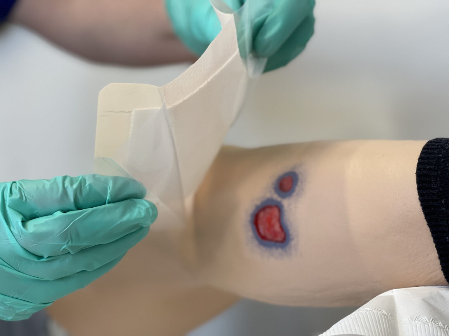 How to change a simple wound dressing - Wirral Community Health and ...